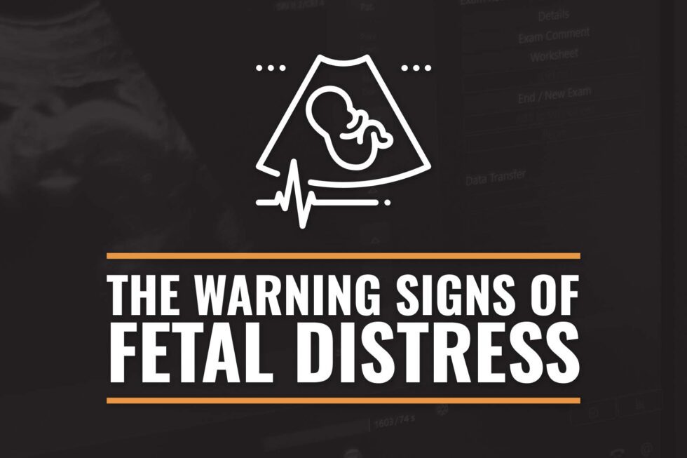 The Warning Signs of Fetal Distress | Signs, Symptoms & Causes