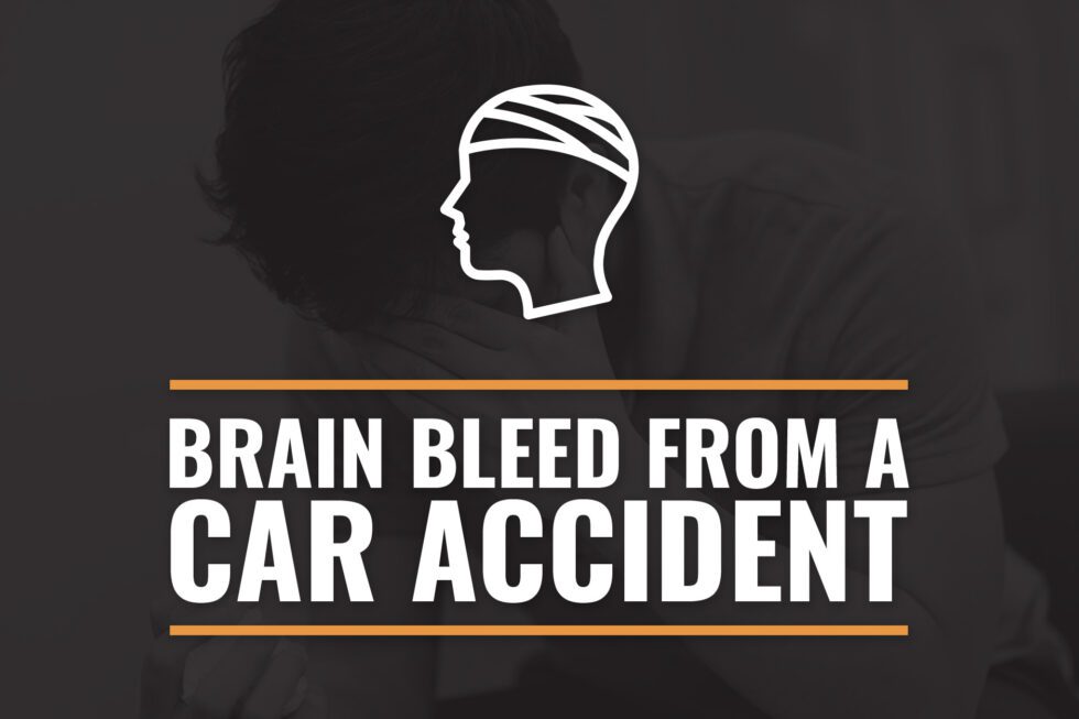 Brain Bleed From a Car Accident | Symptoms & Treatment